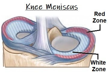 Knee Meniscus & Cartilage - Knee Pain Explained